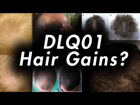 DLQ01: A New (better) Minoxidil?