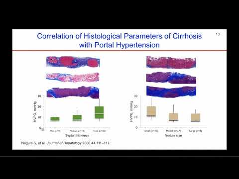Endpoints for Trials in NASH Cirrhotics