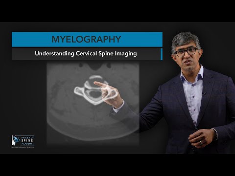 What is Myelography of the Cervical Spine?