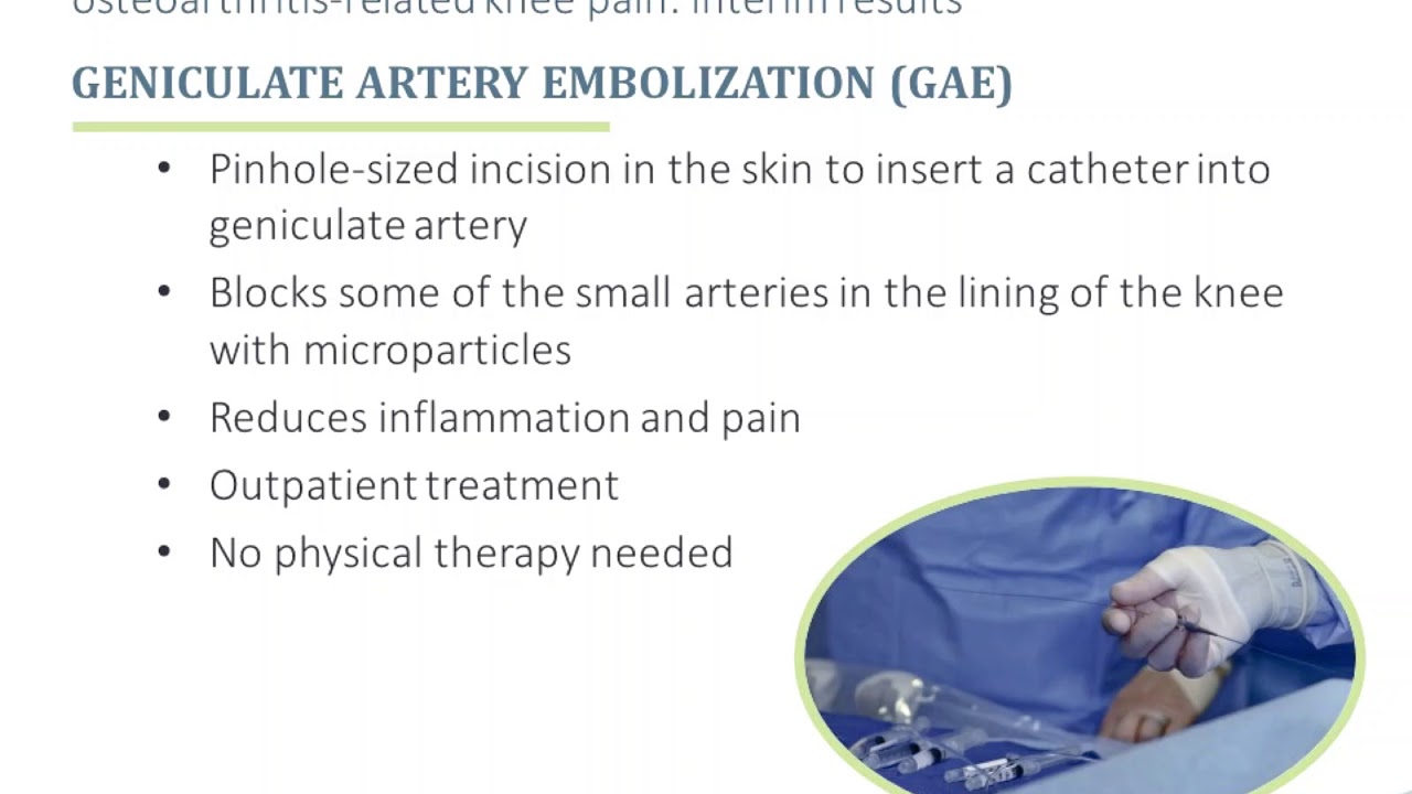 Minimally invasive treatment reduces knee pain and disability from osteoarthritis