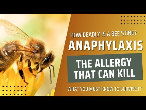How Deadly is a Bee Sting? Anaphylaxis: The Allergy That Can Kill — What You MUST Know