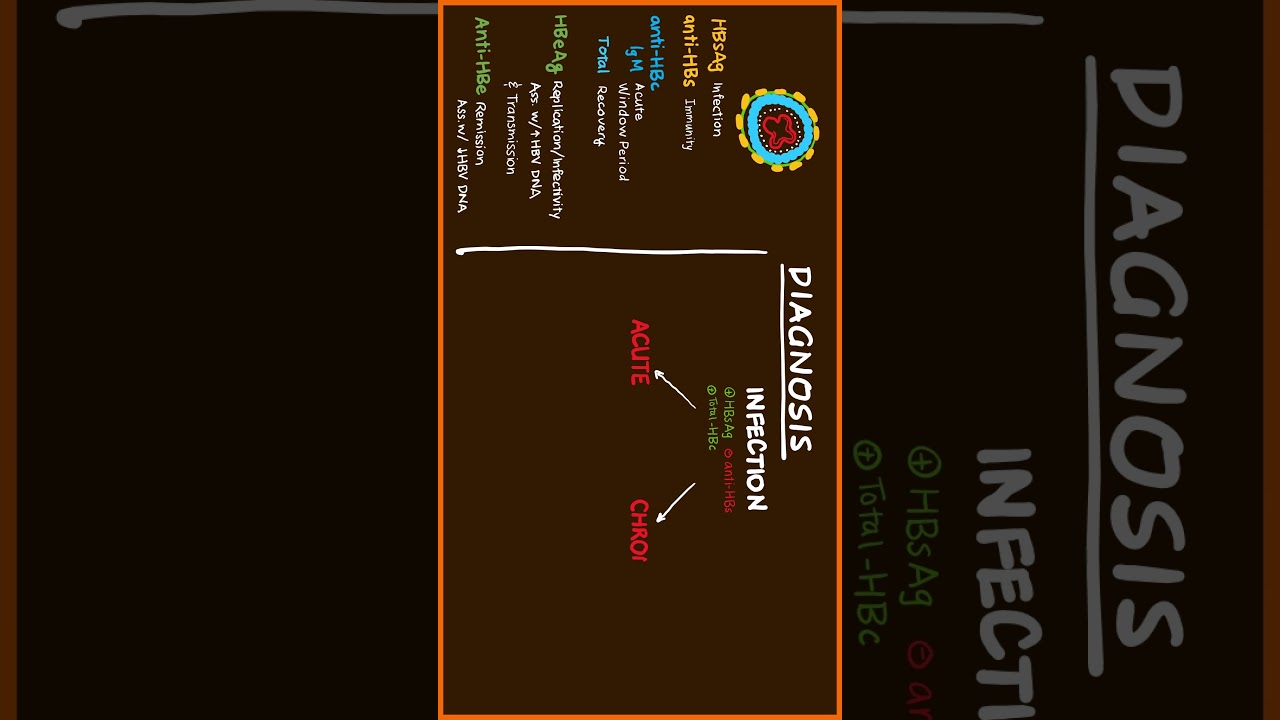 Part 1/3 Hepatitis B Diagnosis #usmle