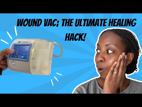 Wound Vac Explained: Faster Recovery Starts Here