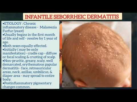 Baby Rash - Part 5 | Cradle Cap / Infantile Seborrheic Dermatitis Causes, Symptoms, & Treatment