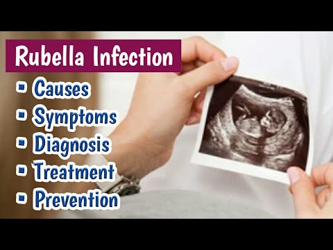 Rubella - German Measles Cause, Symptoms, Prevention & Treatment | Congenital Rubella Syndrome CRS