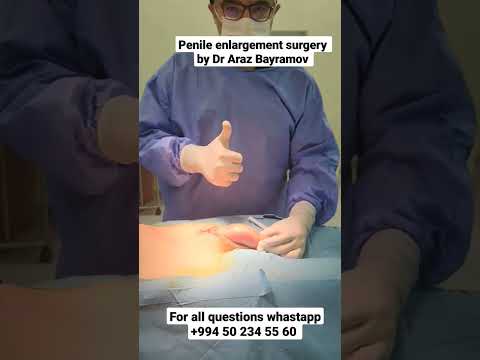 Penile enlargement surgery by Dr Araz Bayramov AUA member , EAU active member #andrologist #penis