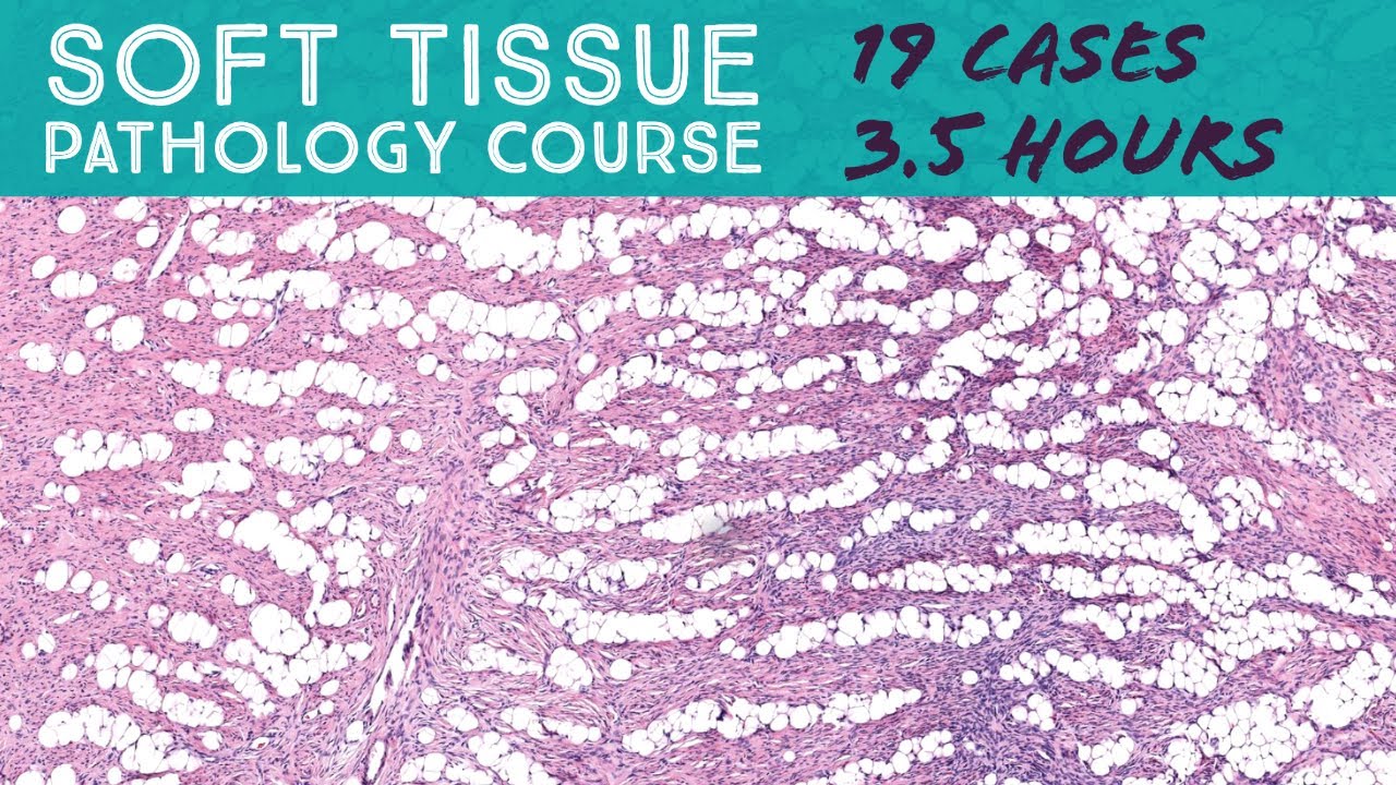 Soft Tissue Pathology Course: 19 Cases in 3.5 Hours (Oregon Pathologists Association 2021)