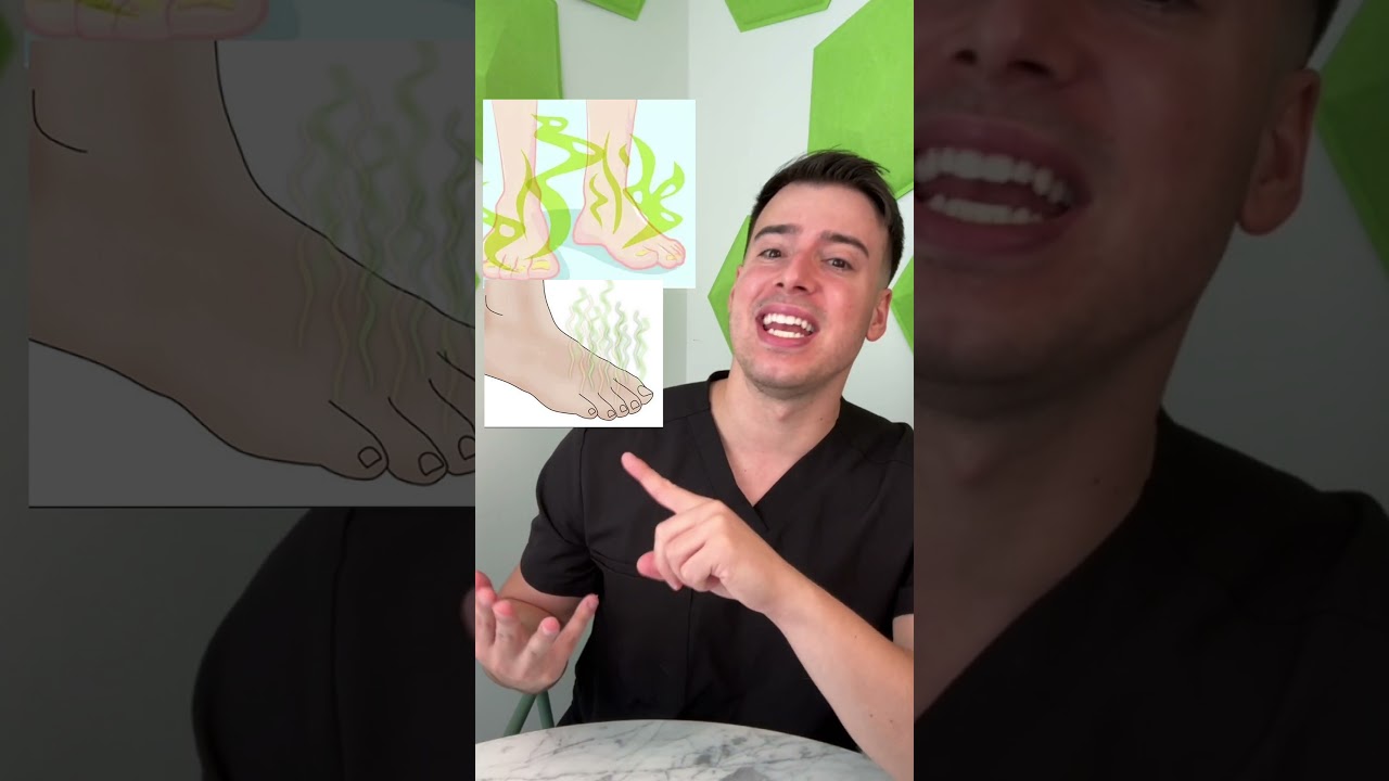 Derm Hack: Smelly Feet