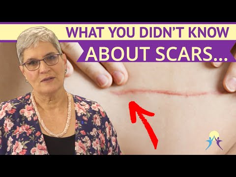 What You DIDN'T KNOW About SCARS And Scar Tissue [Explained]