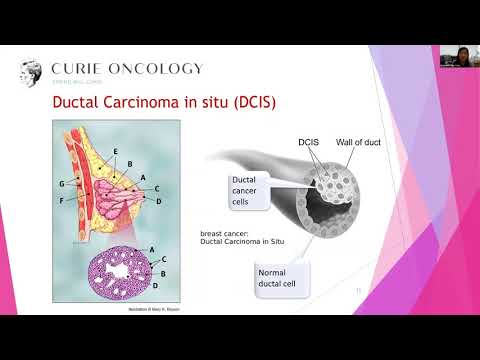 Screening and Diagnosis of Breast Cancer webinar