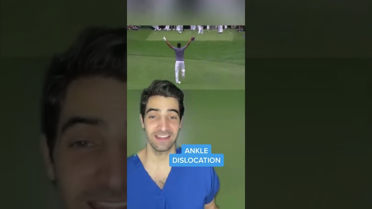 Ankle dislocation