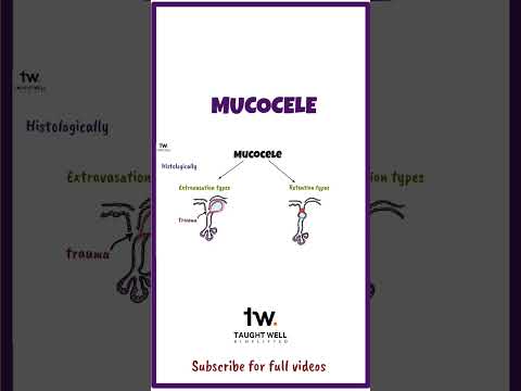 Mucocele | #dentistry #shorts