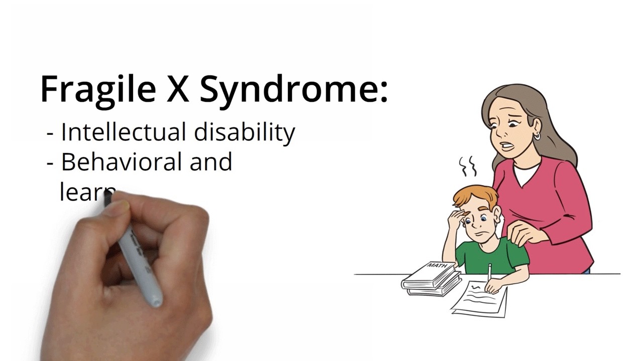 What is Fragile X?