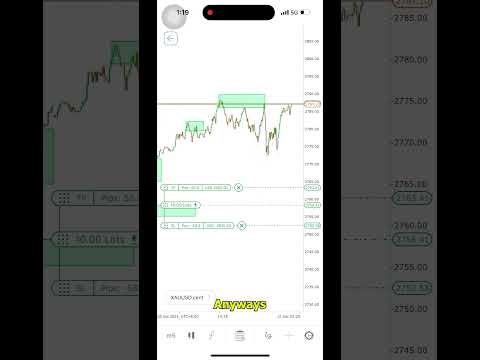 Day 17 of turning $10,000 to $1 Million Dollars | -$1100 Loss