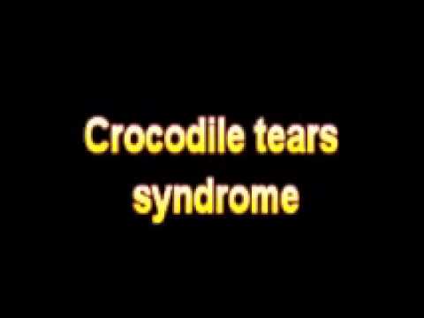 What Is The Definition Of Crocodile tears syndrome - Medical Dictionary Free Online