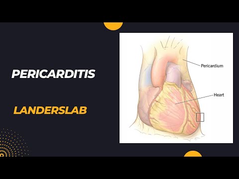 Pericarditis