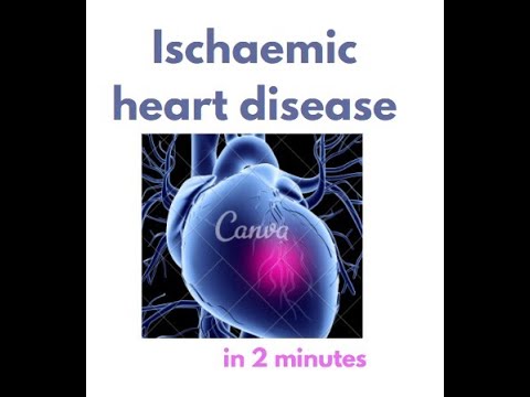 Ischemic Heart Disease in under 2 mins!