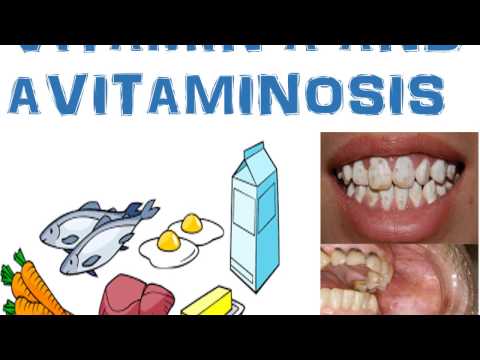 Vitamin A - Synthesis, Regulation, Functions, Deficiency and hypervitaminosis