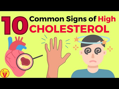 10 Common Signs of High CHOLESTEROL You SHOULD NOT Ignore | VisitJoy