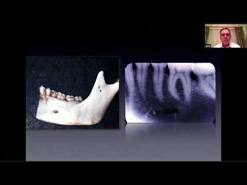 Dr Jerry Cymerman on Endodontic Diagnosis