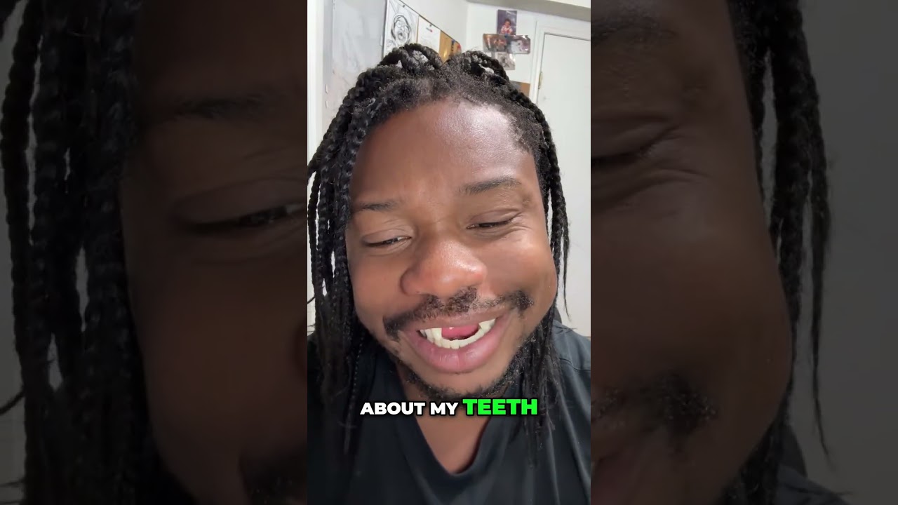 Embrace Imperfections & Smile: Overcoming Insecurity on Livestream #shorts