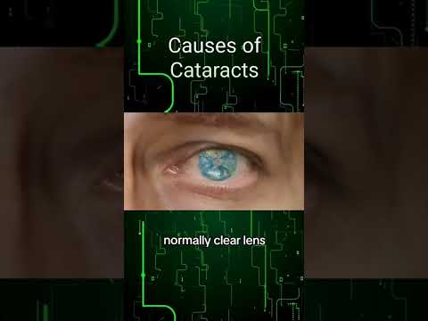 What Causes Cataracts?