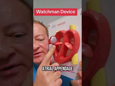 What is the Watchman device for atrial fibrillation? How does it prevent strokes?