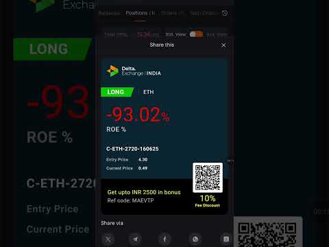 π§ Remember: Losses are part of the game. Even pro traders lose. The key is #psy_trade #optiontrading