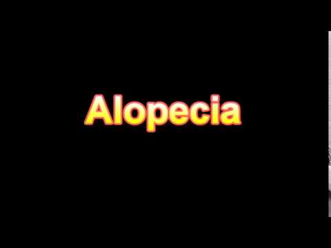 What Is The Definition Of Alopecia (Medical Dictionary Online)
