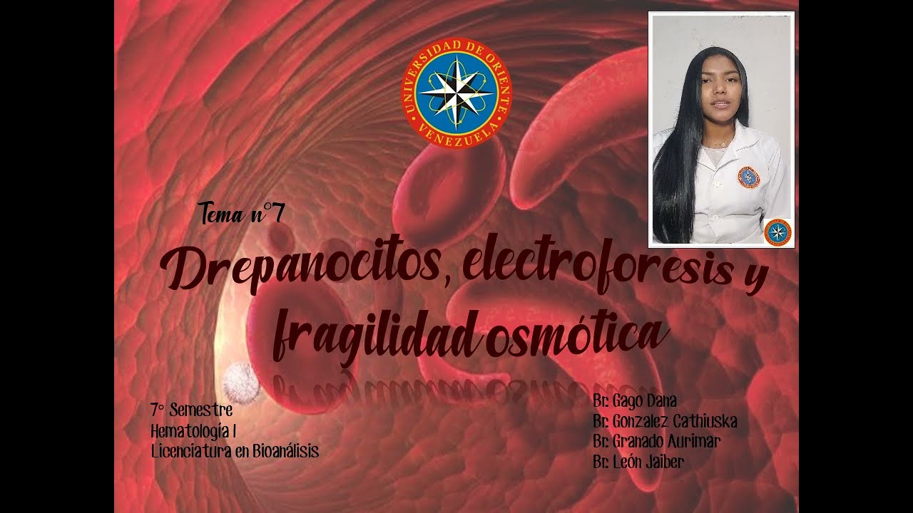 TEMA 7. GRUPO A: Drepanocitos, electroforesis y fragilidad osmótica.