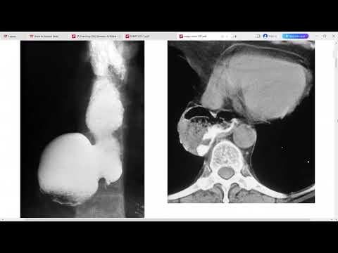 ESOPHAGUS IMAGING EXAM CASES GIT