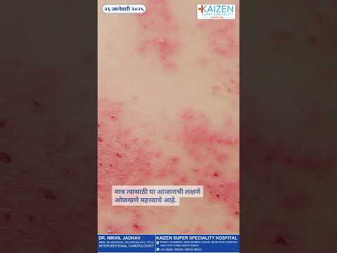 World Leprosy Day 2025 | Recognize Symptoms and Spread Awareness