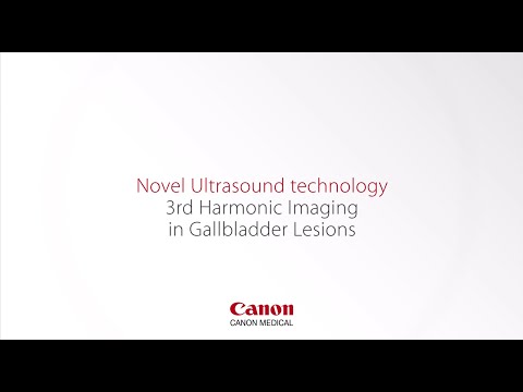 Novel Ultrasound Technology: 3rd Harmonic Imaging in Gallbladder Lesions