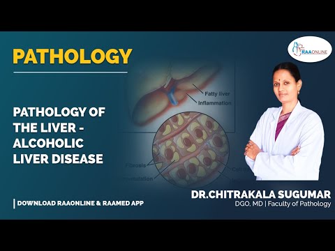 Pathology | Pathology of the liver - Alcoholic liver disease | Raaonline