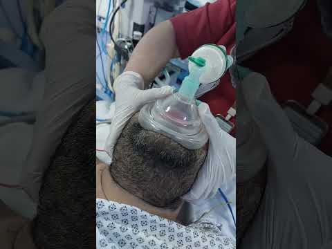 Difficult Mask Ventilation Morbid Obesity #anesthesia #doctoroncall #airwaymanagement @doctorSI