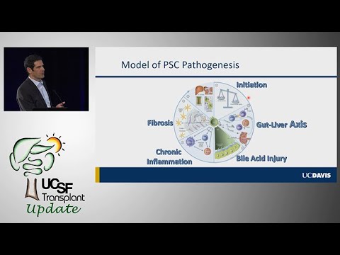 New Frontiers in the Management of PSC