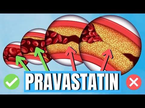 How to use Pravastatin (Pravachol) - Uses, Side Effects, Dosage - Doctor Explains