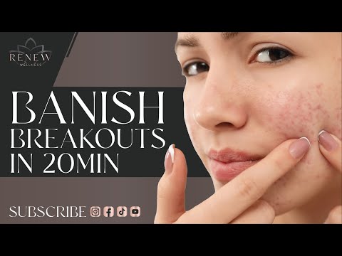 The Fastest Way to Get Rid of Acne: Dr. Patel
