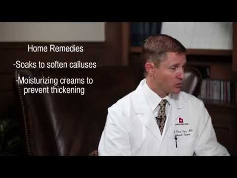 Corns and Calluses Information and Treatment