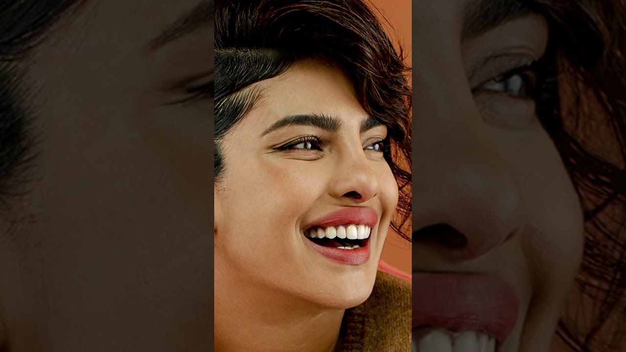 Bollywood Celebrities who got Teeth Braces; Dr. Srishti Bhatia #smilemakeover #newsmile