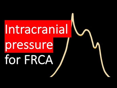 Intracranial pressure (ICP) explained, waveforms and methods