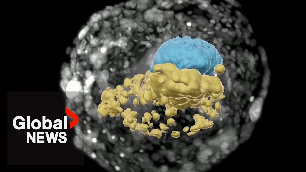 Scientists grow synthetic human embryo without eggs, sperm, or womb
