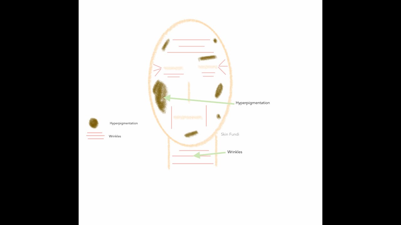 Intrinsic and Extrinsic Ageing