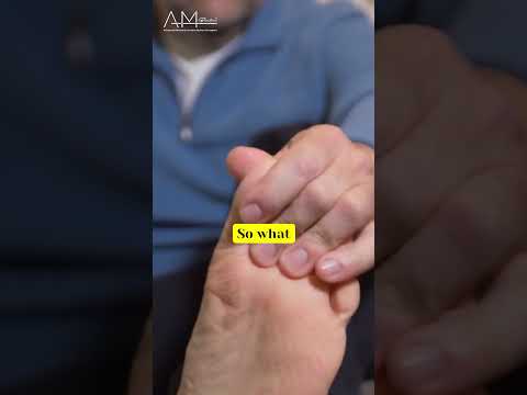 Foot Doctor's Secret to Bunion Relief...