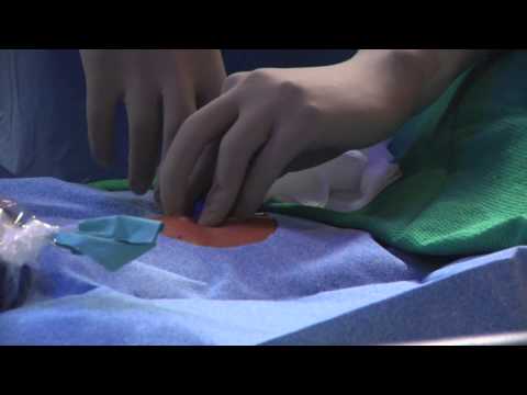 New Cardiac Device Allows Missionary To Travel