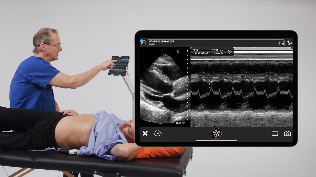 Using EPSS to Assess LV Function