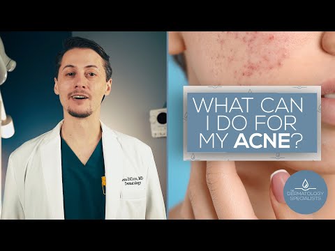What Can I Do For My Acne?