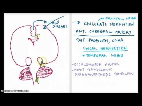 Brain Herniation Syndromes - Neurology - Medbullets Step 1