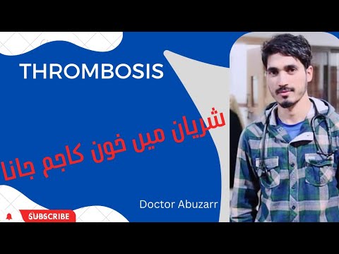 thrombosis 3d animation :Deep vein animation: Symptoms, Causes and treatment. Urdu