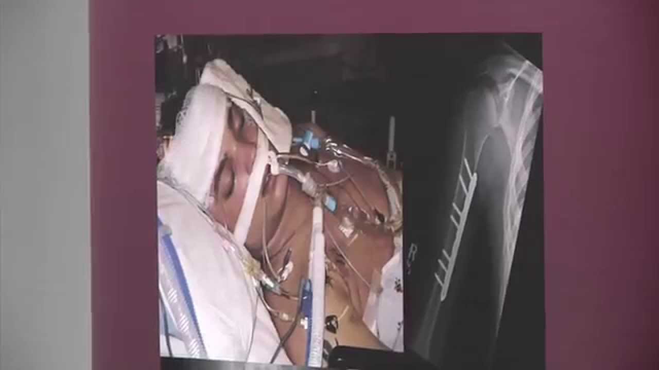 Bryan Drunk Driving Presentation